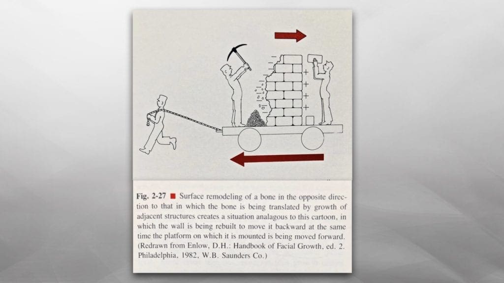 Proffit Lecture Part 2: The influence of “the book”. - Kevin O'Brien's ...