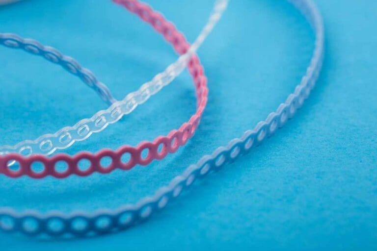 Back to basics: 10 Interesting Tips for Orthodontic Space Closure