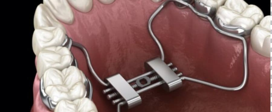 Kevin O'Brien's Orthodontic Blog